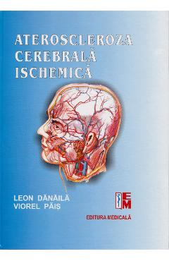 Ateroscleroza cerebrala ischemica - Leon Danaila, Viorel Pais ...